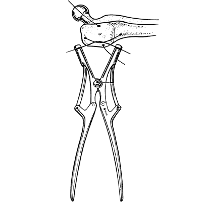 Harris Wire Knot Tightener 10" - 40-1530 - Each - Surgical Instruments ...